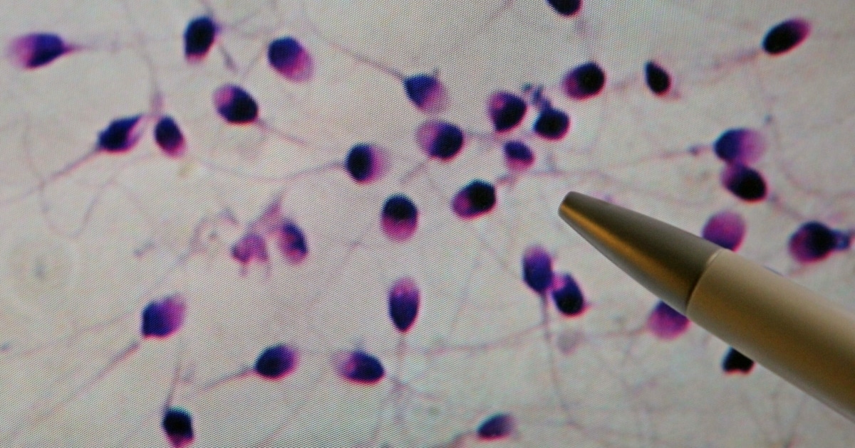 The number of sperm cells in men is declining at an increasingly rapid ...