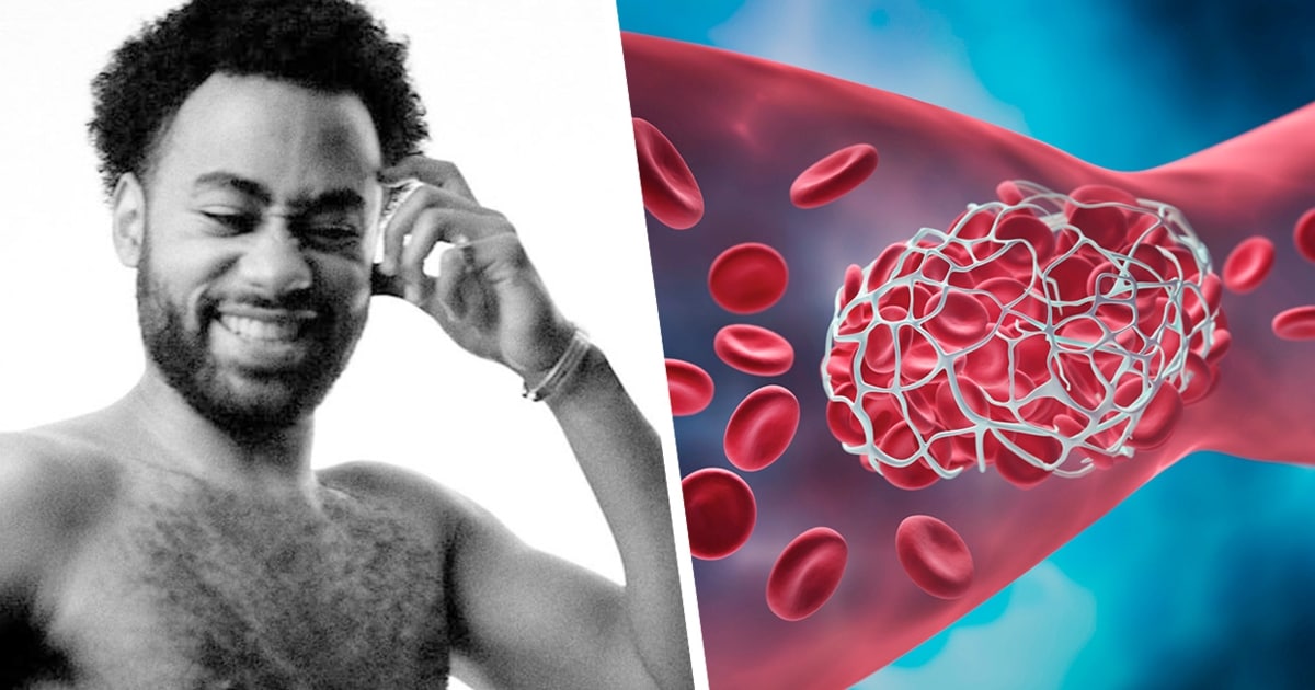 Anzeichen erkennen - Tod von Pablo Grant: So gefährlich ist Thrombose ...