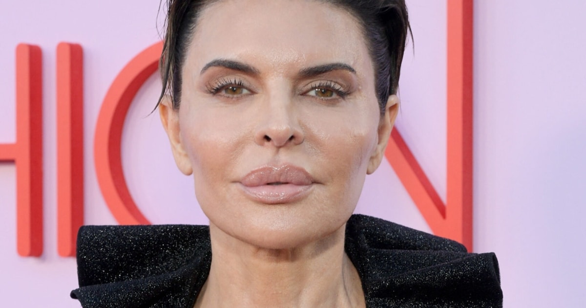 „Nicht gut für mich“ - Zu viel Filler! Lisa Rinna bereut Beauty-Eingriff | krone.at