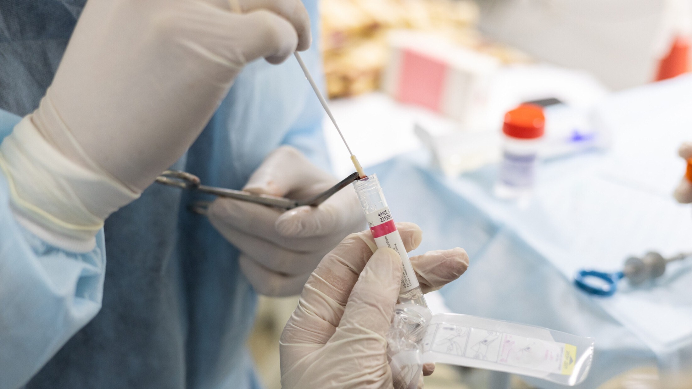 During surgery - Tumor tissue is now analyzed in five minutes | krone.at