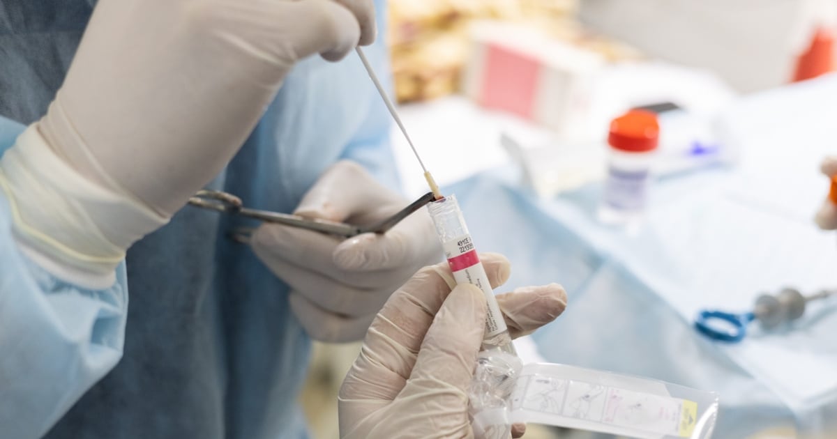 During surgery - Tumor tissue is now analyzed in five minutes | krone.at