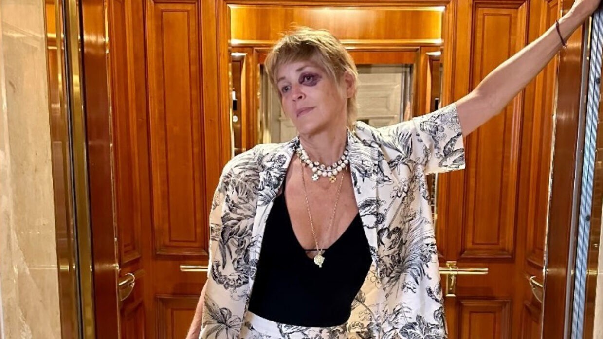Fans ins Sorge - Sharon Stone meldet sich mit blauem Auge auf Insta ...