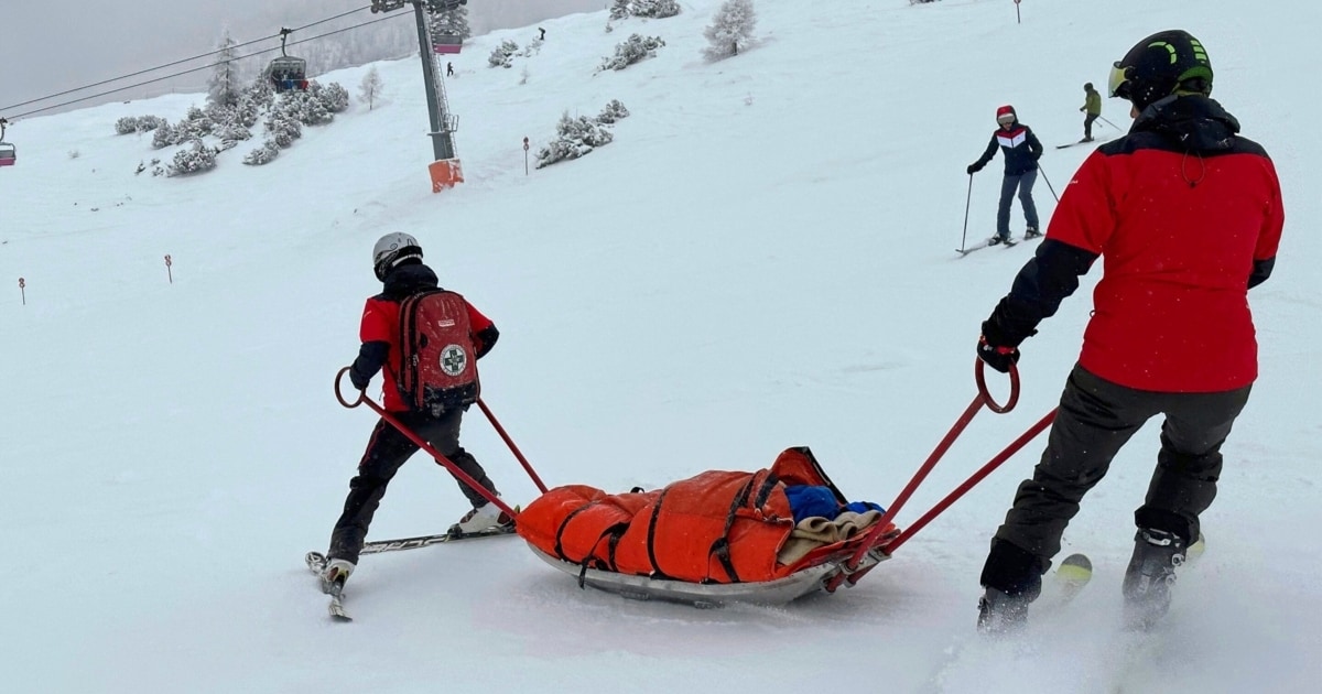 Serious skiing accidents - Run over skis, hand and face – then escape ...
