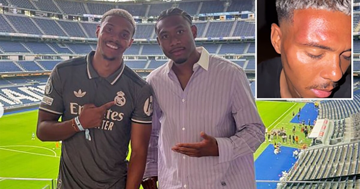 Shows injuries - Because of Bayern jersey: Attack on Alaba’s buddy ...