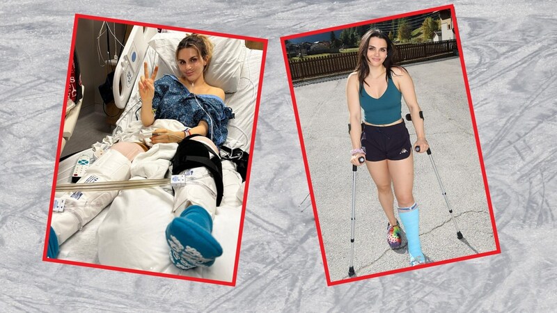 Unbelievable bad luck - After 4 cruciate ligament ruptures: Broken ...