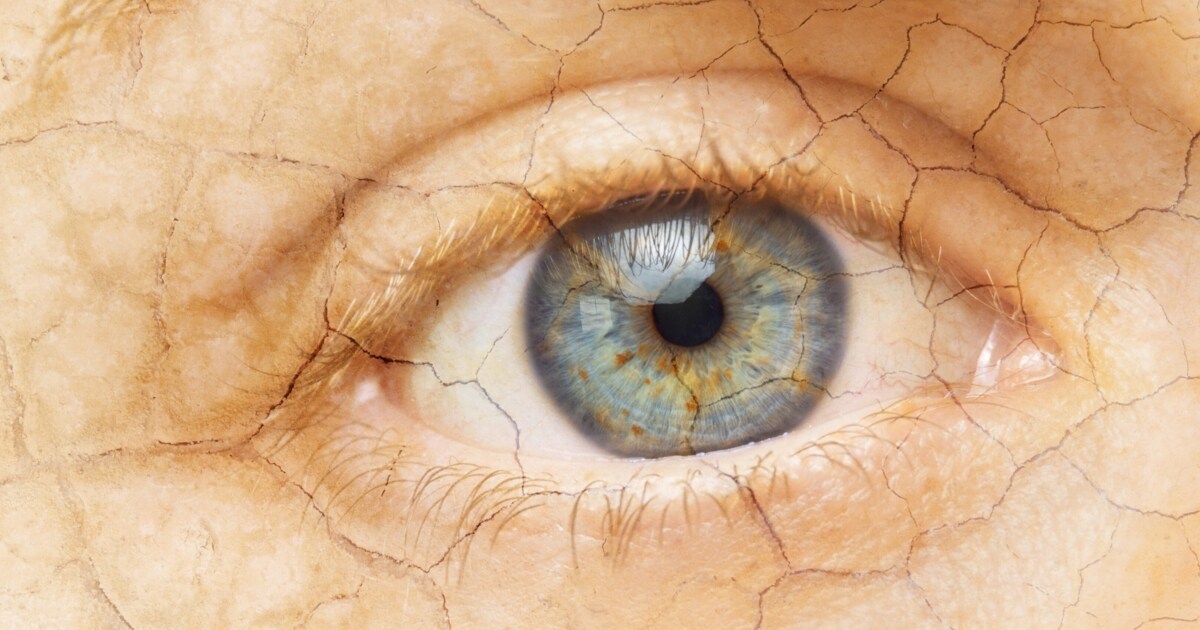 Causes and therapy - The problem of dry eyes: the “desert” in the eye ...