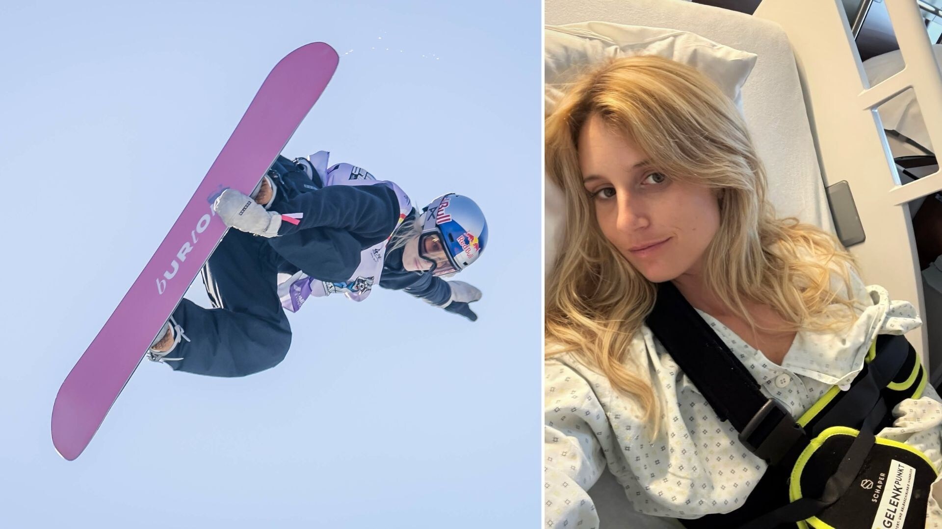 Vor Olympiasaison - Sturz beim Surfen! Anna Gasser bereits operiert | krone.at