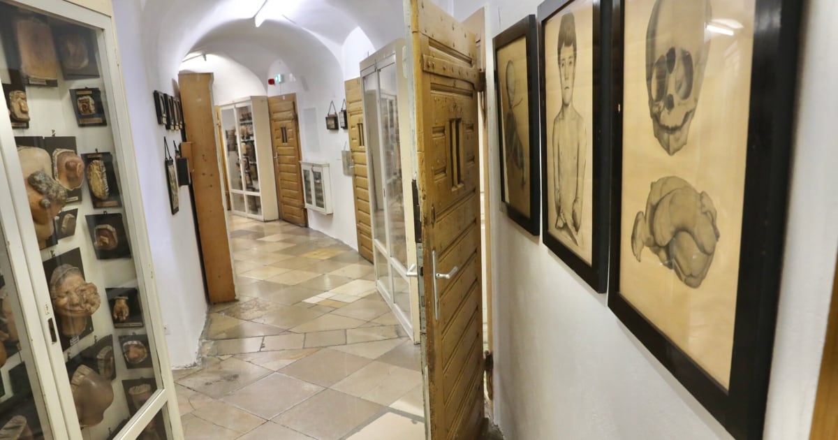 Neue Ausstellung - Narrenturm zeigt Kunstwerke menschlichen Siechtums ...