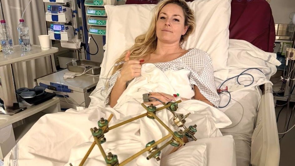 Compartment syndrome - Vonn reveals: Leg almost had to be amputated ...