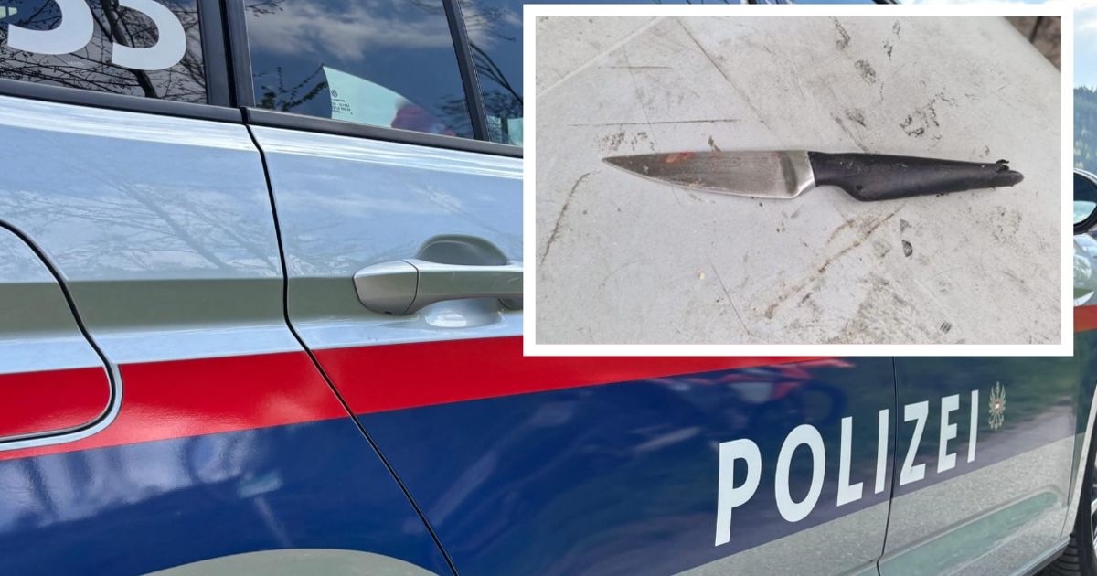 Tiefe Schnittwunde - Frau sticht mit Gemüsemesser zu – Mann im Spital ...